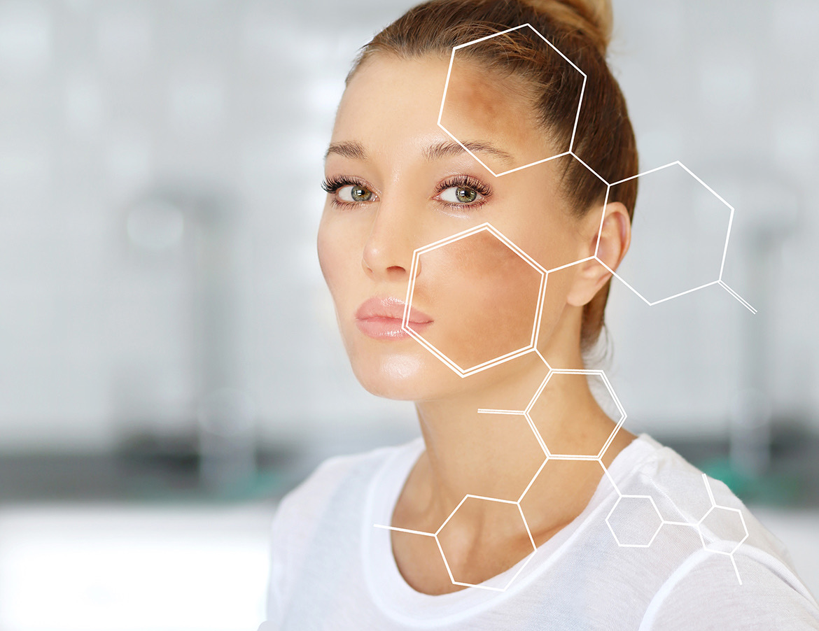 Υπερμελάγχρωση, οι σκούρες κηλίδες που θα ήθελες να εξαφανιστούν ...