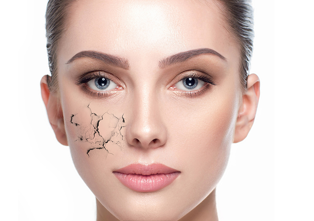 Ξηρή επιδερμίδα: Συμπτώματα, αιτίες και αντιμετώπιση! - Inalia Φυσικά ...